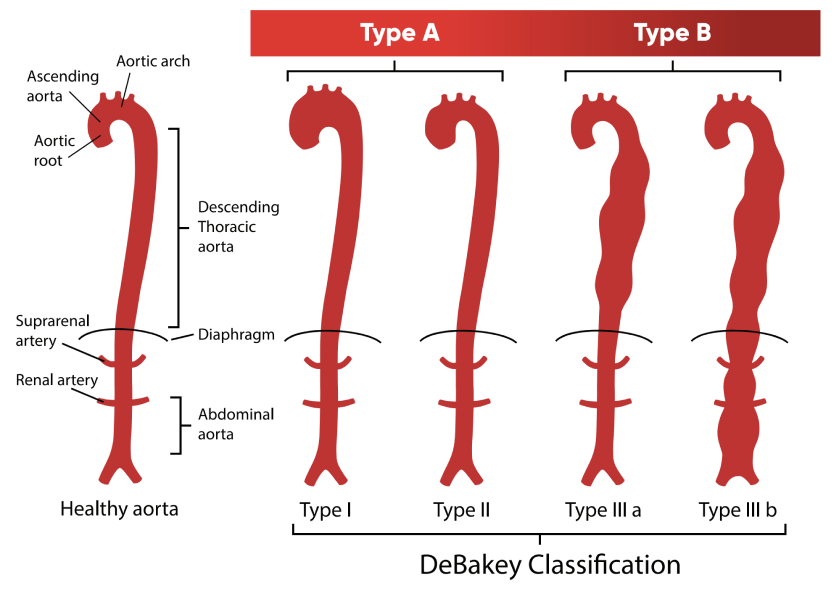 General Practice – Aortic Surgical Network